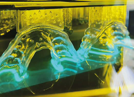 Digital Nightguards – Oswestry Dental Laboratory